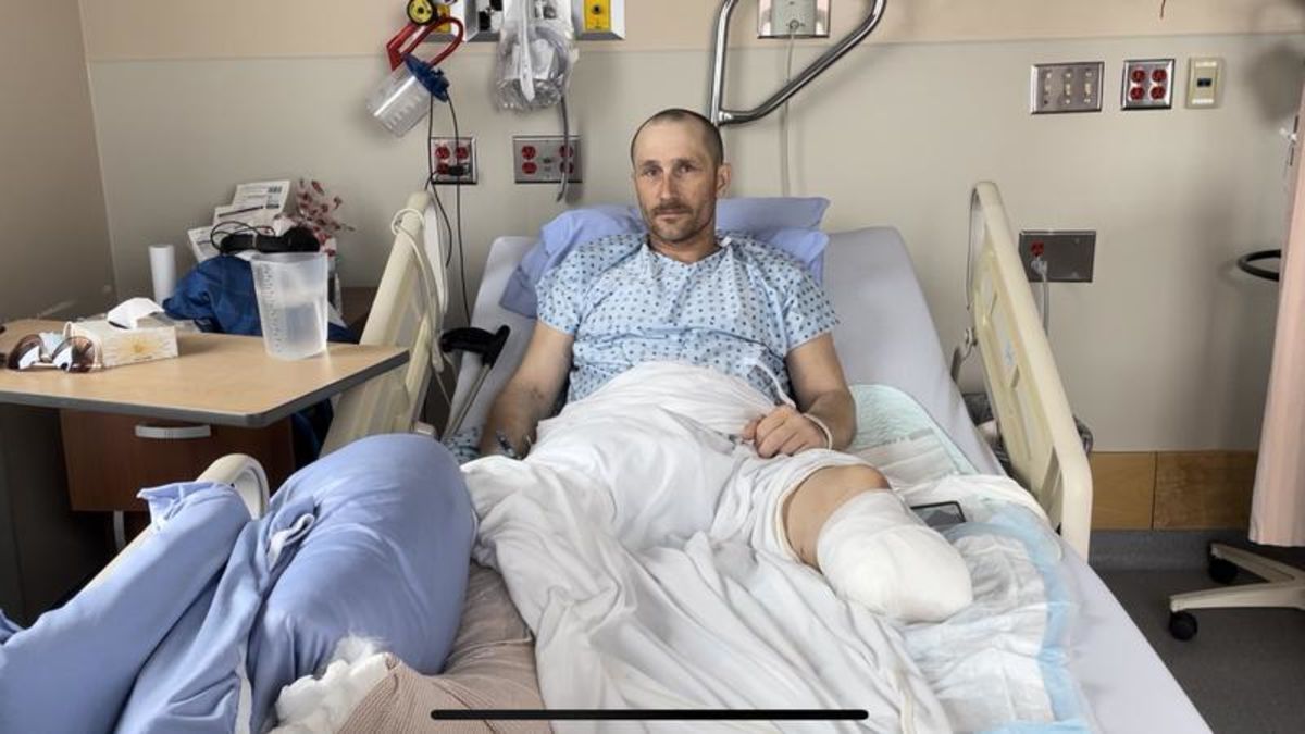 Local man loses leg in workplace accident | CKPG Today