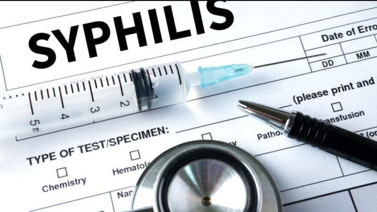 Syphilis still growing with 639% increase since 2019 | paNOW